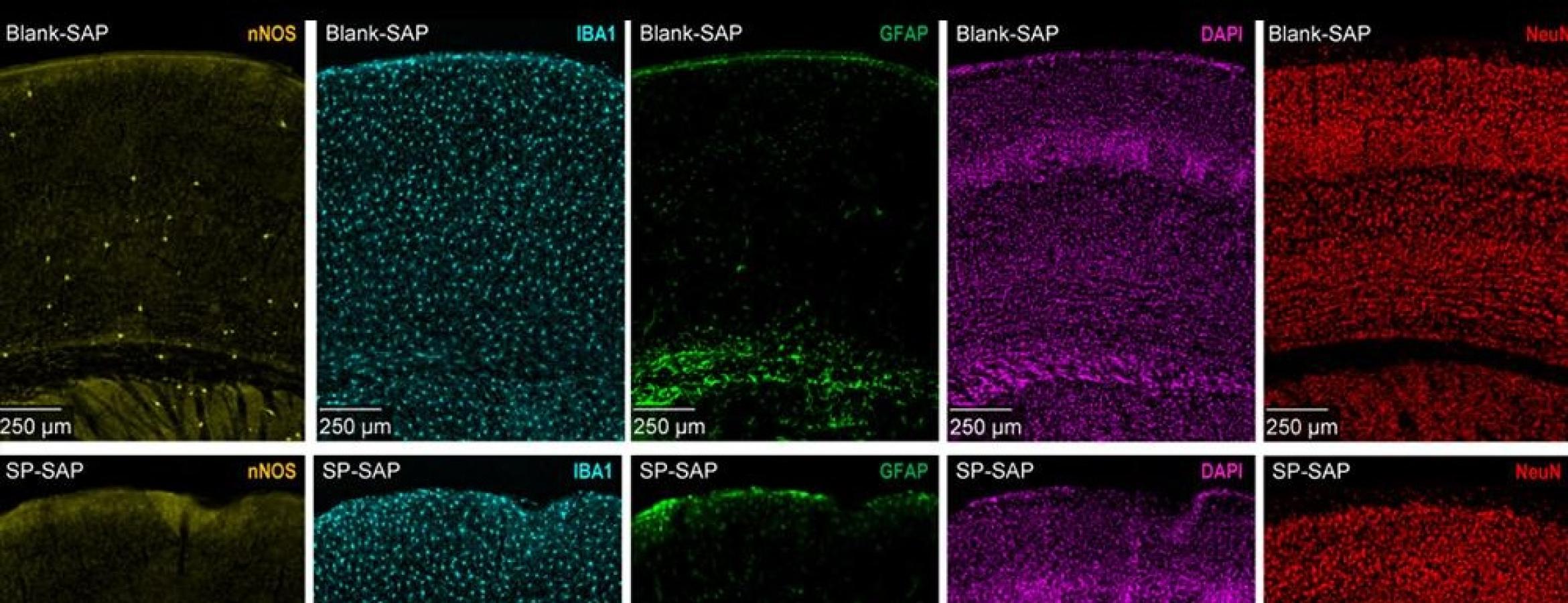It’s not just in your head: Stress may lead to altered blood flow in ...